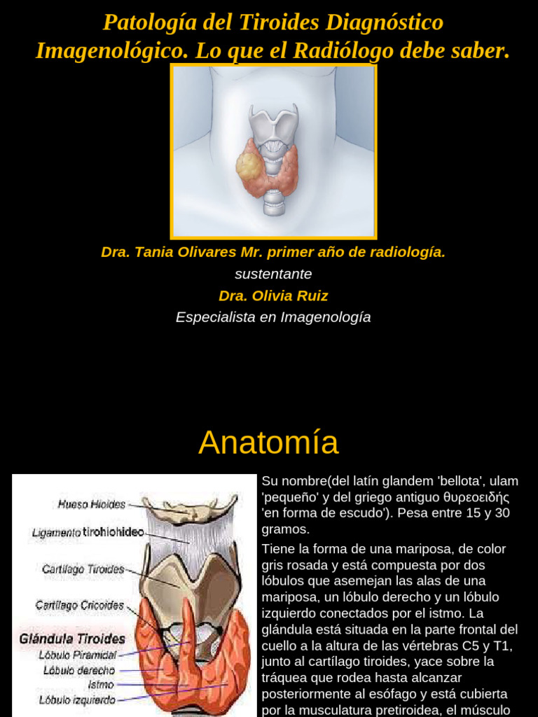 Presentacion Tirads | PDF | Tiroides | Cáncer