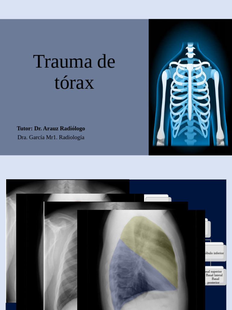 Torax 115811 | PDF | Tórax | Pulmón