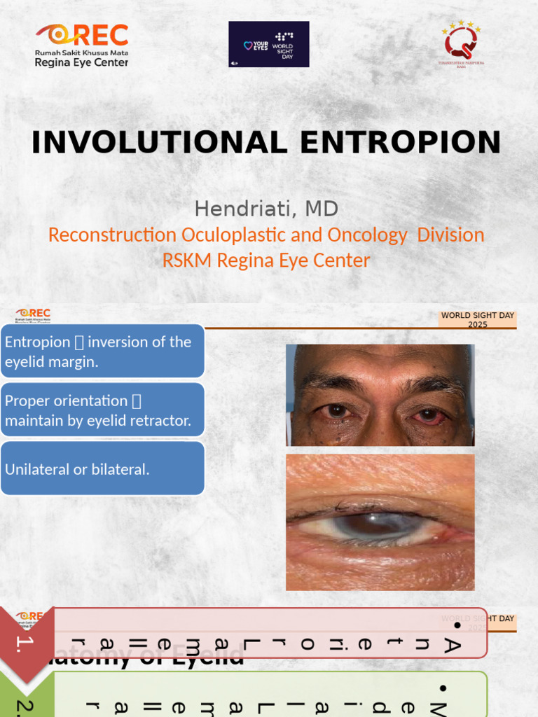 Dr. Hendriati, Entropion Involusional | PDF | Medical Specialties ...