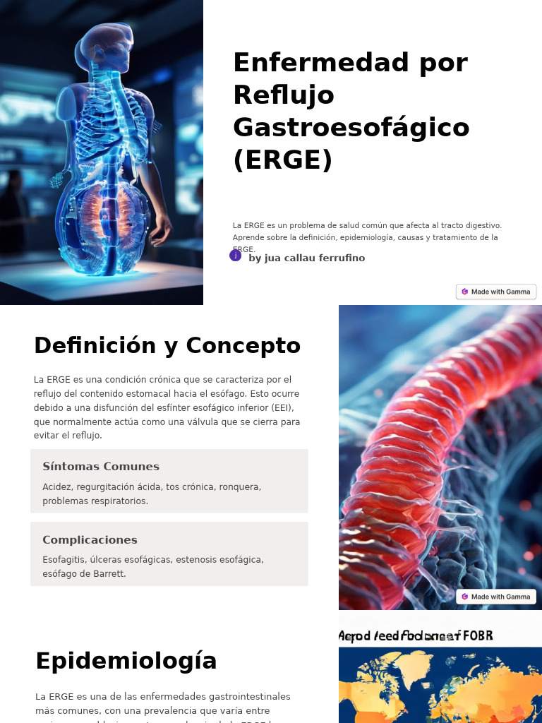 Enfermedad Por Reflujo Gastroesofagico ERGE Un Enfoque ...
