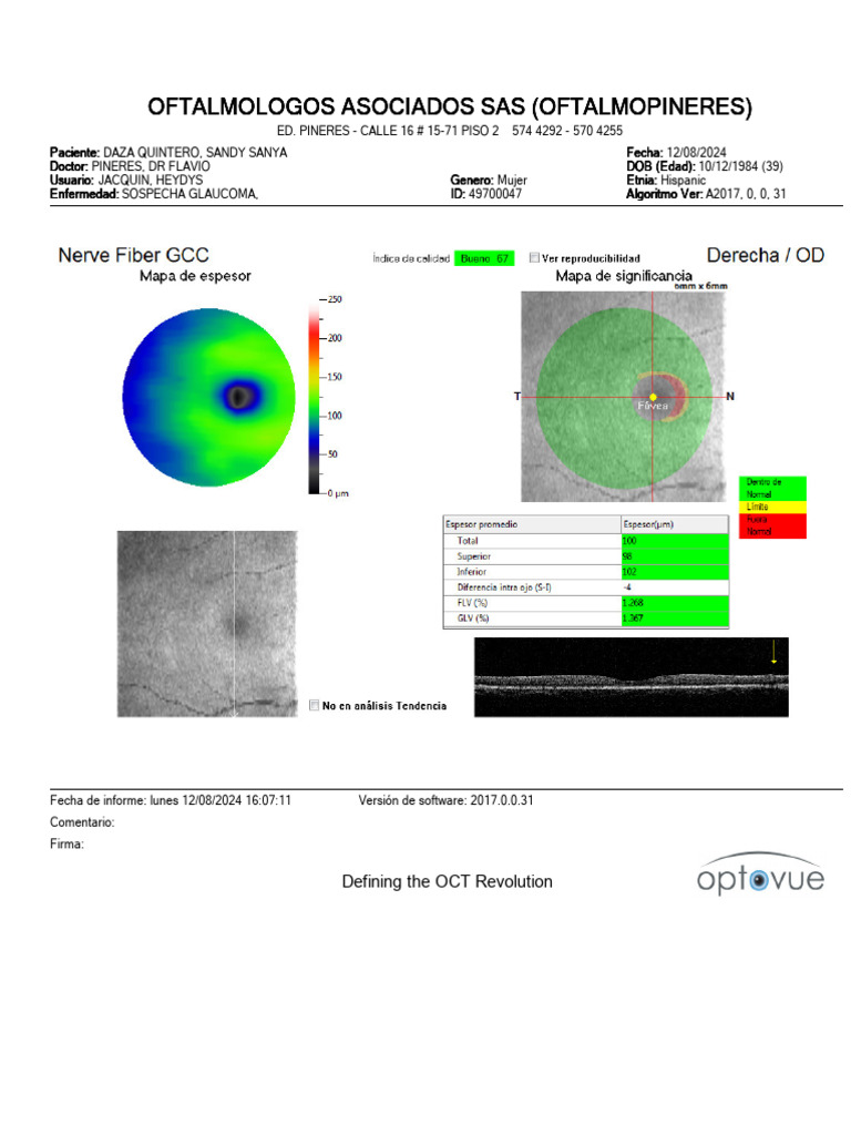 Oct Nervio - Paquimetria - Sandy Sanya Daza Quintero | PDF