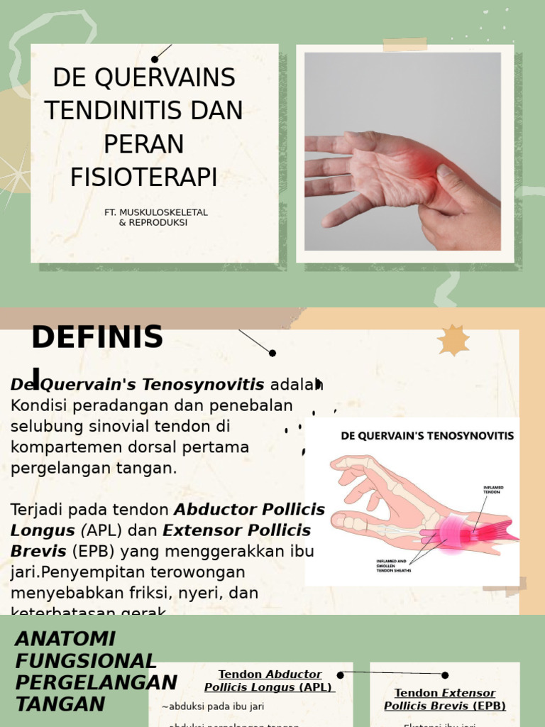 Fisioterapi untuk De Quervain's Tendinitis | PDF