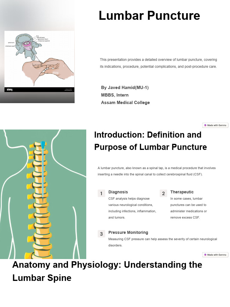 New Lumber Puncture Presentation by Javed | PDF | Cerebrospinal Fluid ...