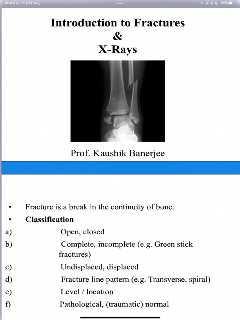 Ortho X-Ray | PDF