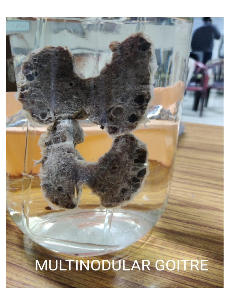 Surgery Specimens Complete | PDF