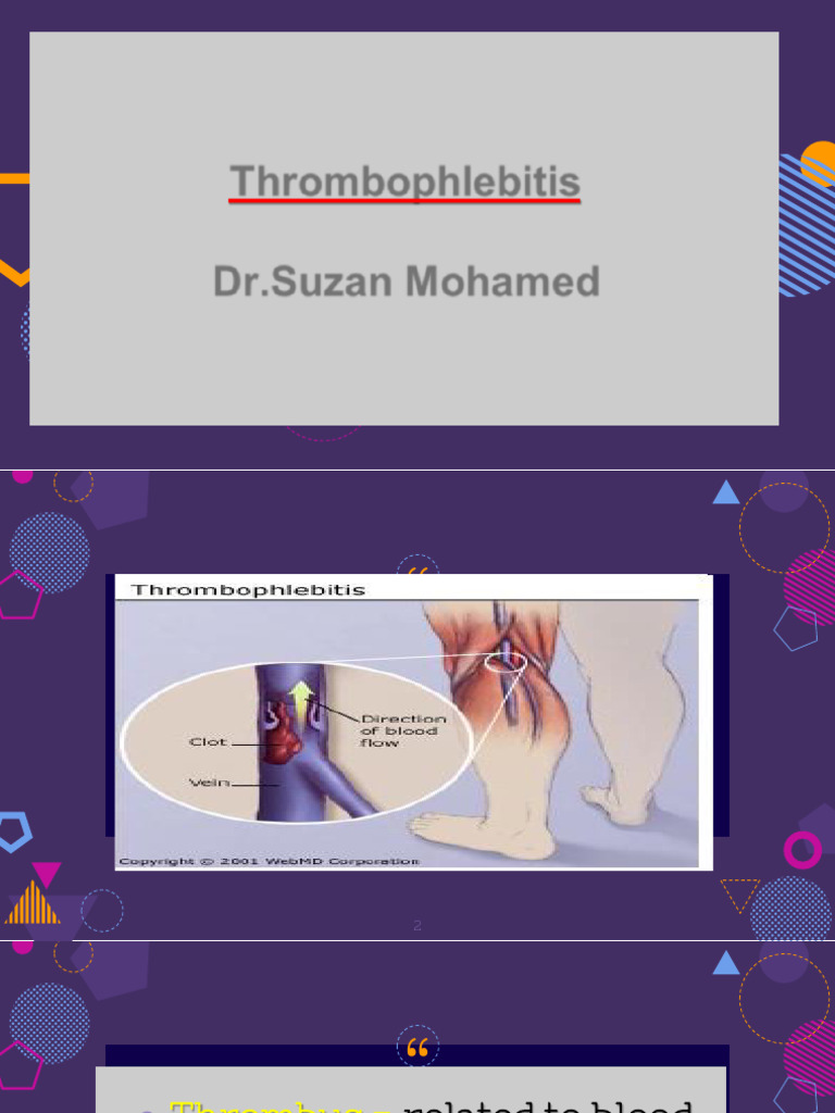 Thrombophlebitis | PDF | Thrombus | Vein