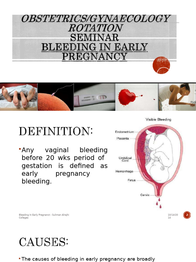 Early Pregnancy Bleeding Causes & Management | PDF | Miscarriage ...