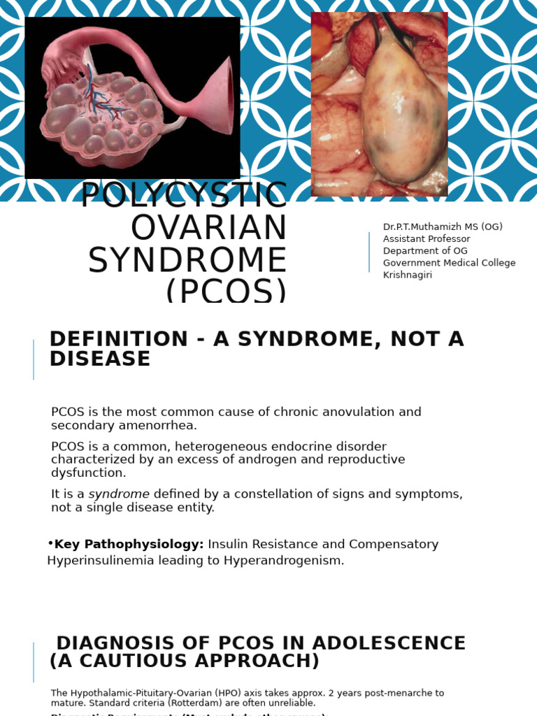 Understanding Polycystic Ovarian Syndrome | PDF | Polycystic Ovary ...