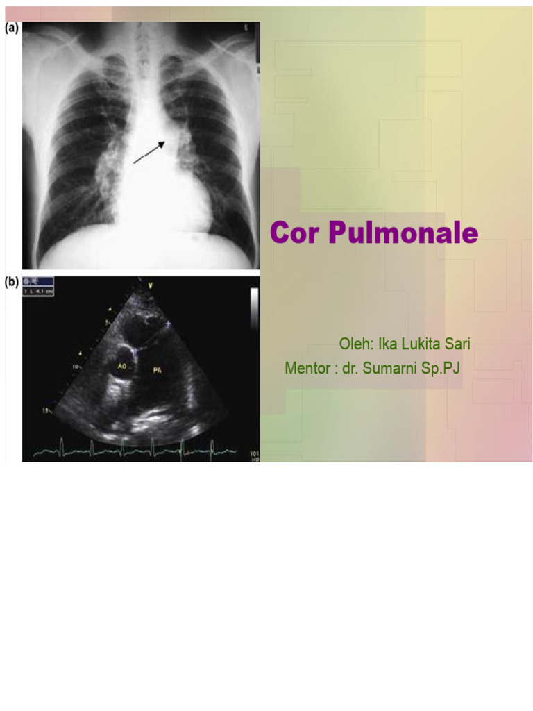 Cor Pulmonale Ika | PDF