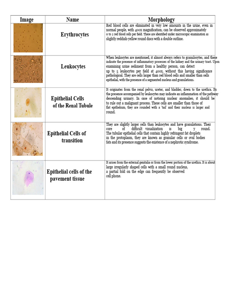 Urine Sediment Analysis: Cell Types & Crystals | PDF | Urinary System ...