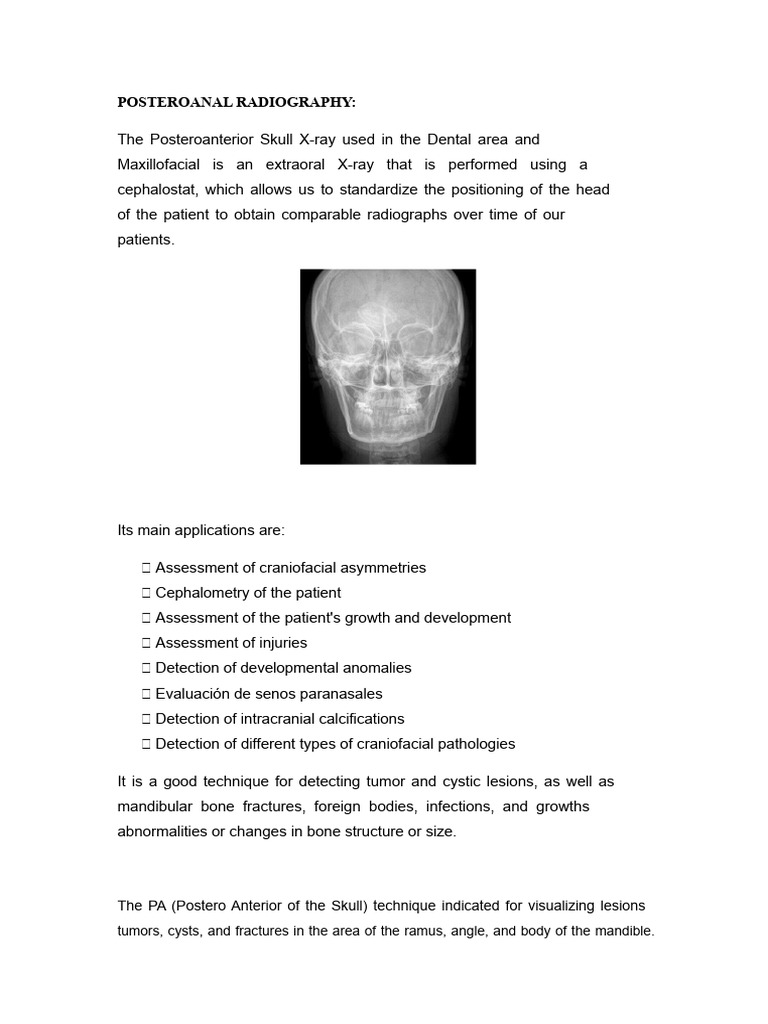Posteroanterior Skull X-ray Techniques | PDF | Skull | Human Nose