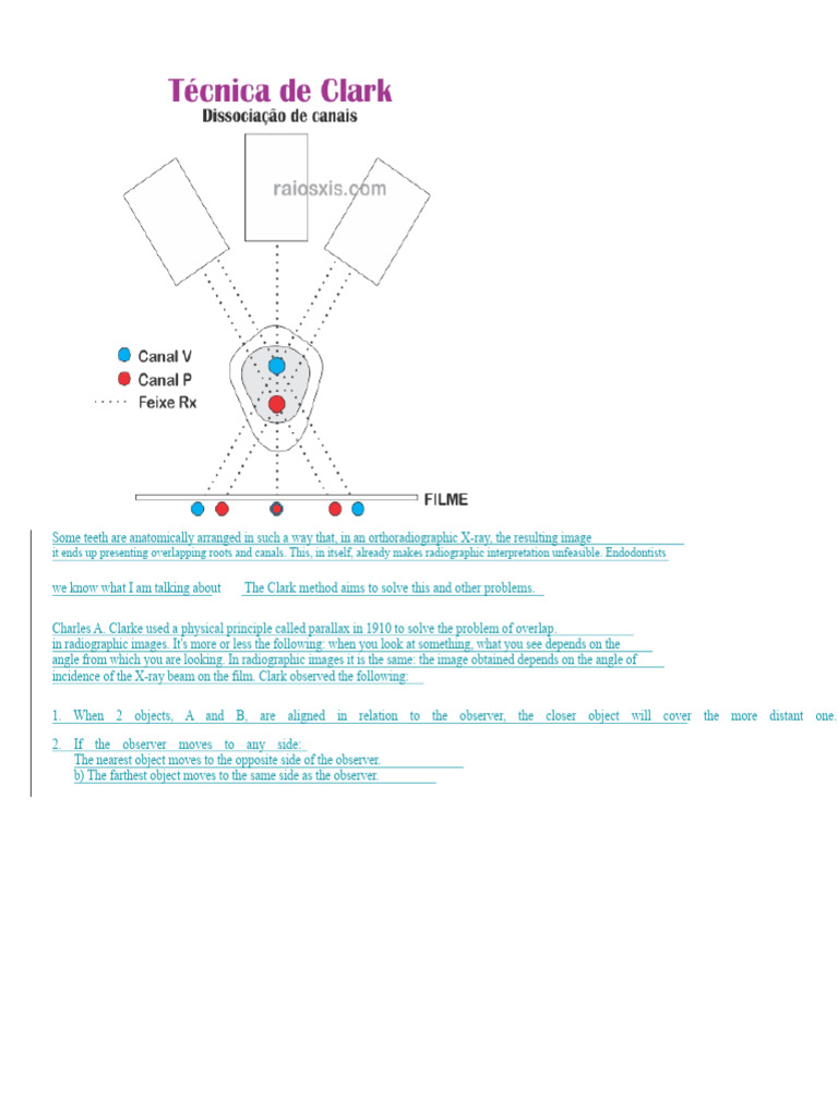 Clark Method for Radiographic Clarity | PDF | Dental Anatomy ...