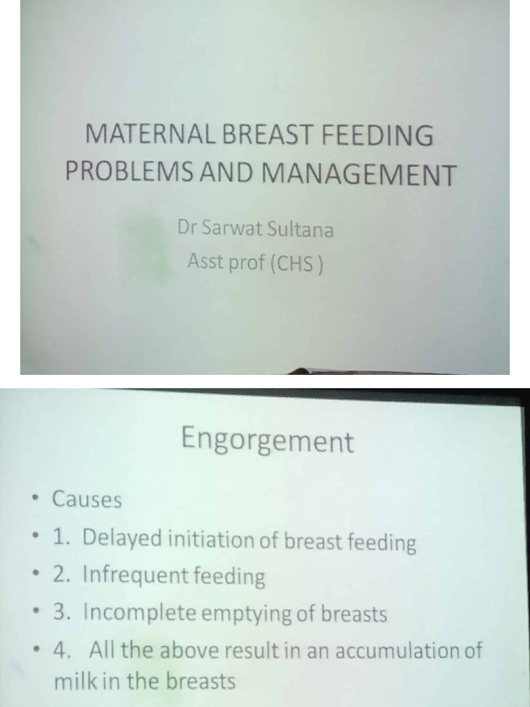 Maternal Breast Feeding Problem and Management | PDF