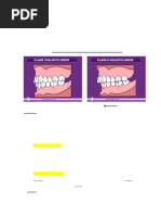 Class II & III Jaw Relations in Dentures | PDF | Mouth | Dental Anatomy