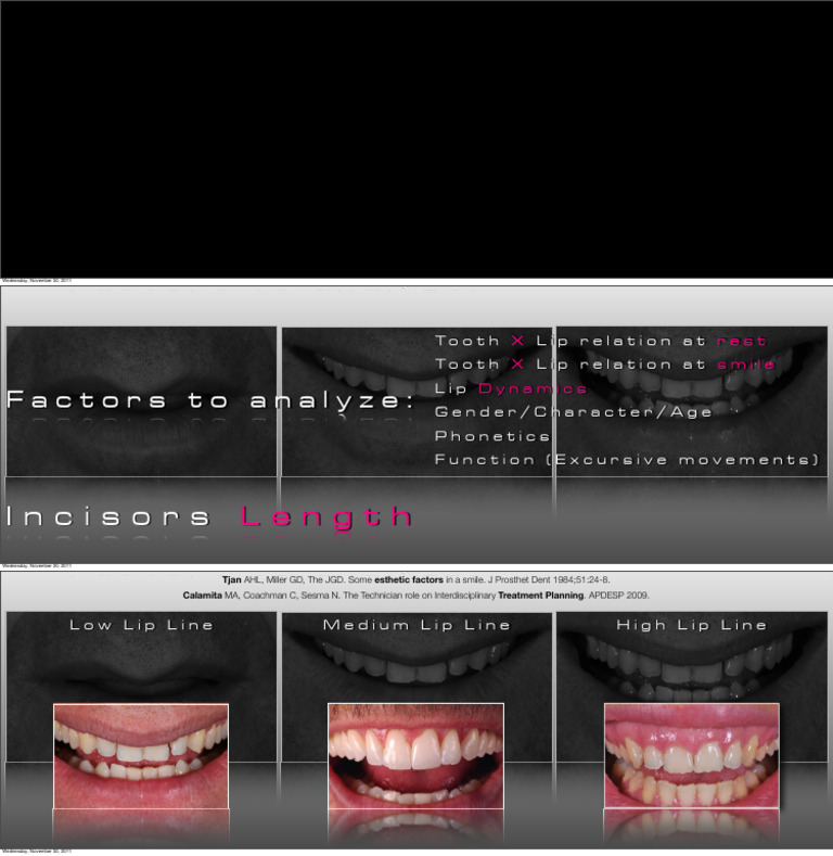 Presentación Muck Up | PDF | Tooth | Dental Anatomy