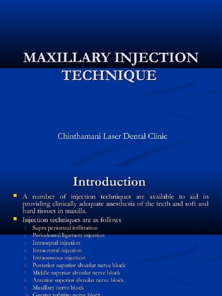 Maxillary Injection Technique PPT | PDF
