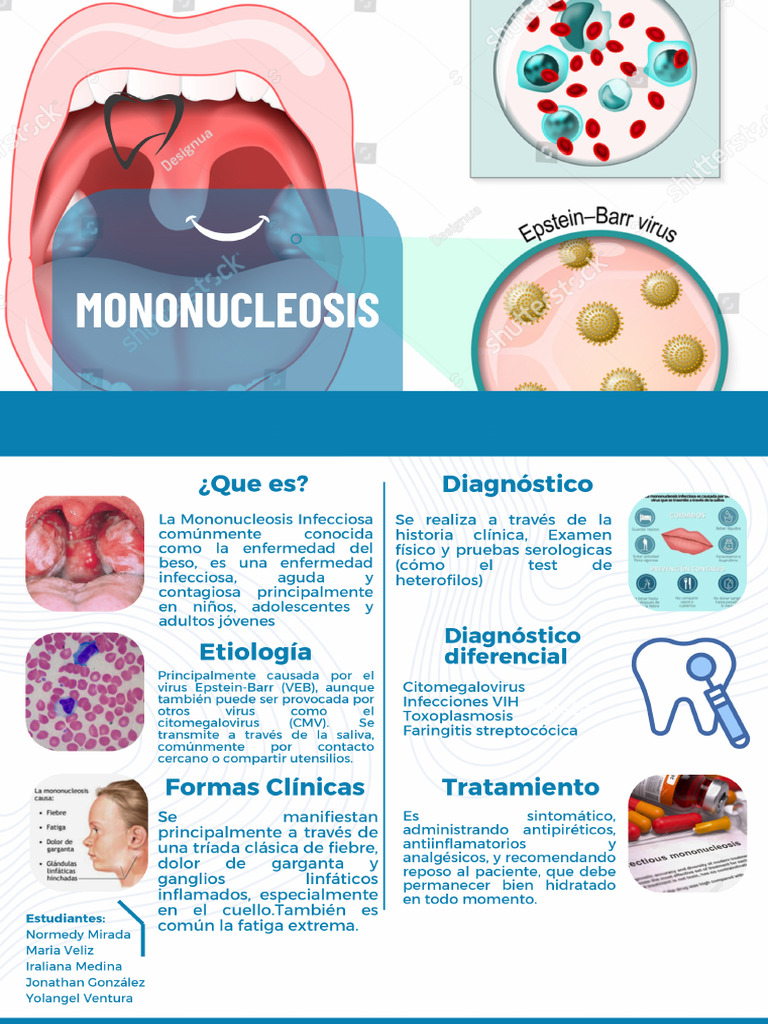 La Mononucleosis PDF | PDF