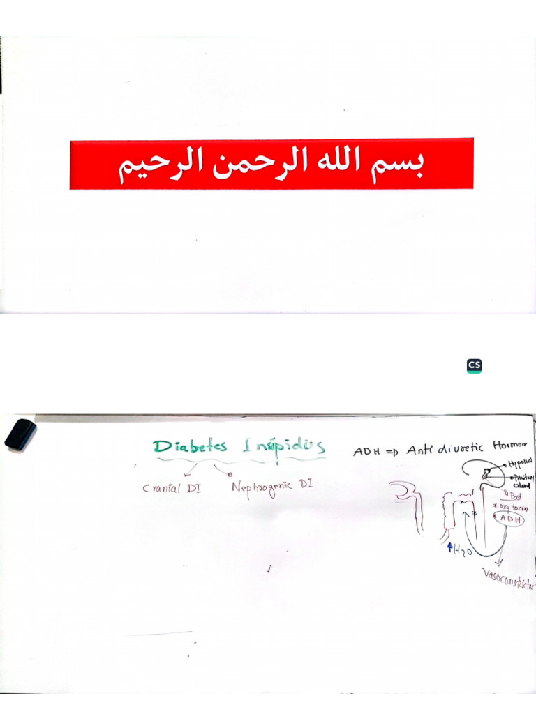 Hypothyroidism Rasekh Sahib | PDF