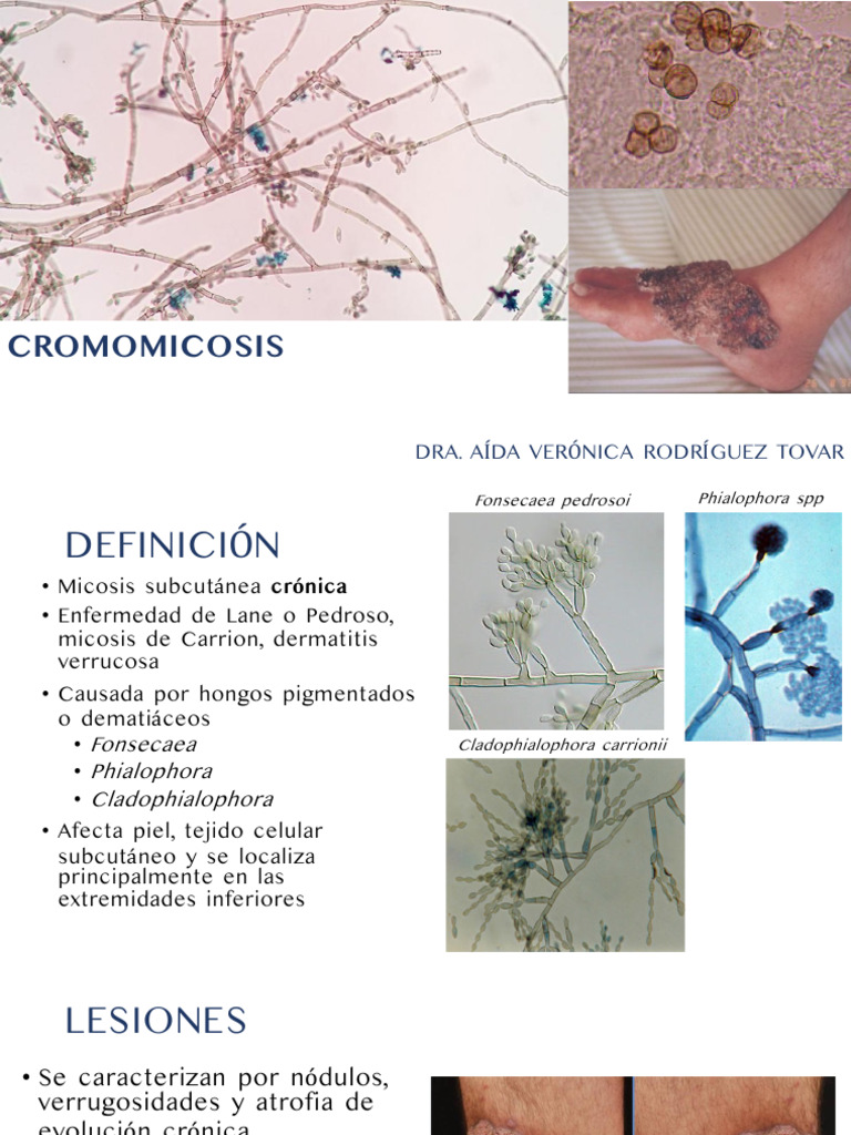 Cromomicosis Oct 23 | PDF | Especialidades Medicas | Enfermedades y ...