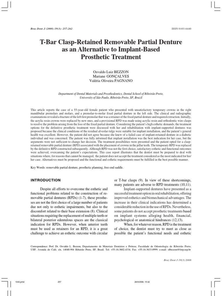 T-Bar Clasp RPD: A Prosthetic Alternative | PDF | Dentures | Dental Implant