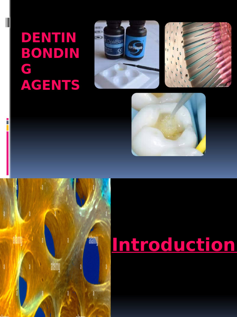 Dentin Bonding Agents | PDF | Dentin | Dental Composite