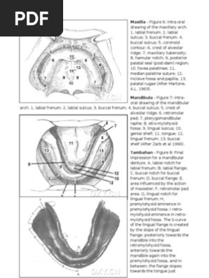 Retromylohyoid Fossa