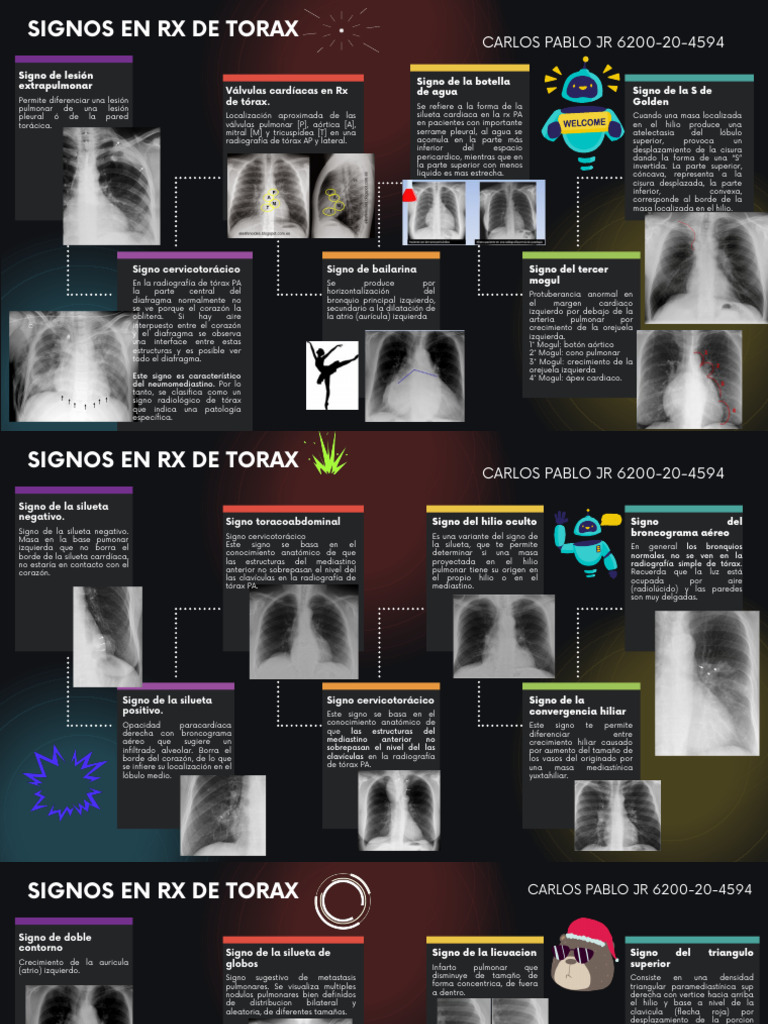 Signo del hilio tapado en radiografías | PDF | Pulmón | Tórax