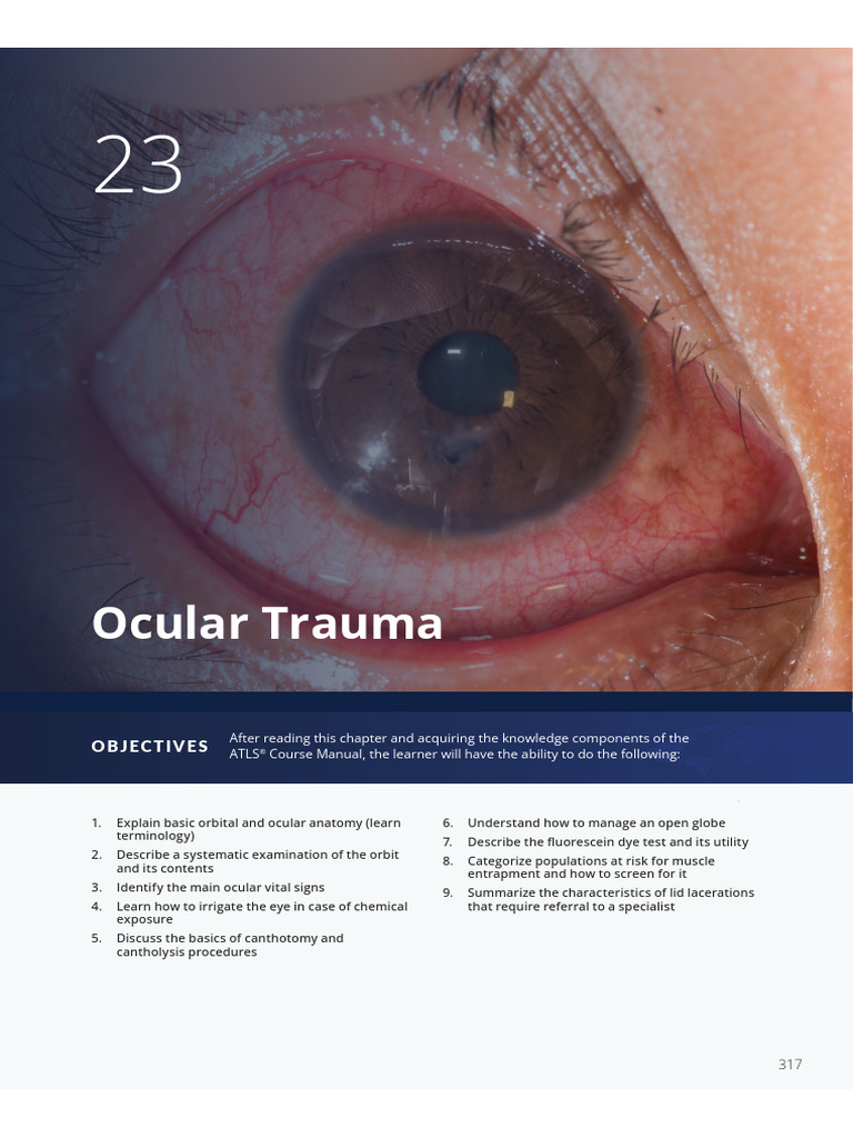 Trauma ocular 2025 | PDF | Human Eye | Ophthalmology