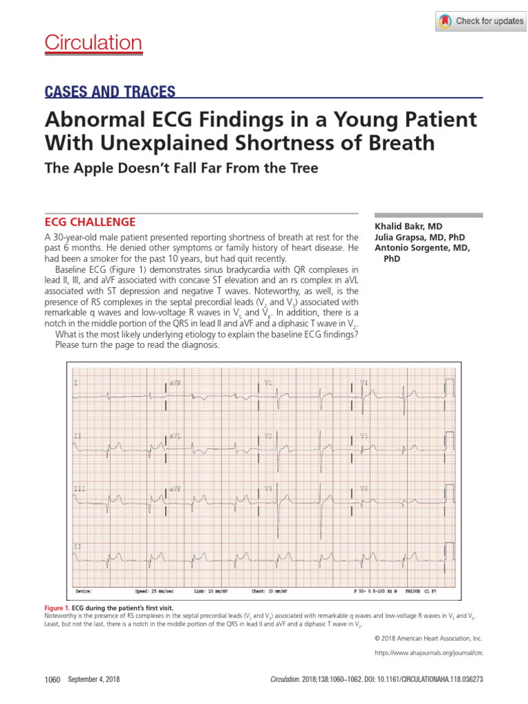 Bakr Et Al 2018 Abnormal Ecg Findings in a Young Patient With ...