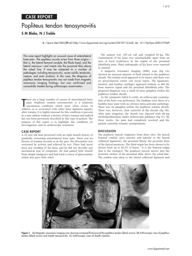 Popliteus Tendon Tenosynovitis. Br J Sports Med | PDF | Knee ...