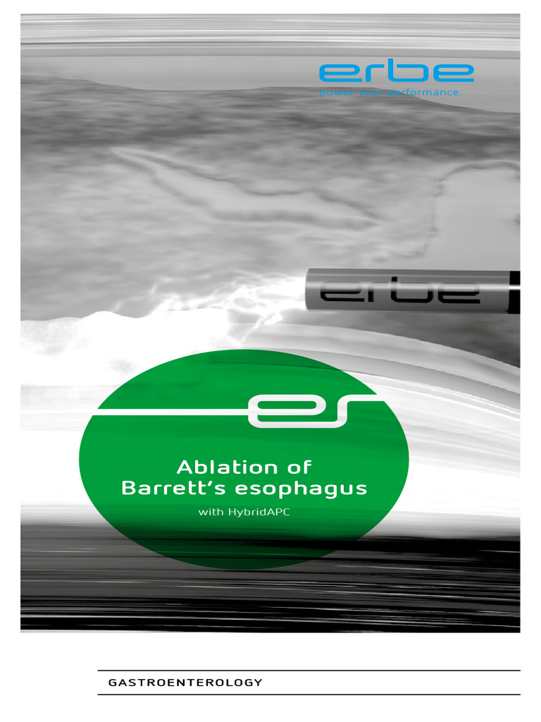 ERBE en Barrett Ablation With HybridAPC | PDF | Esophagus ...