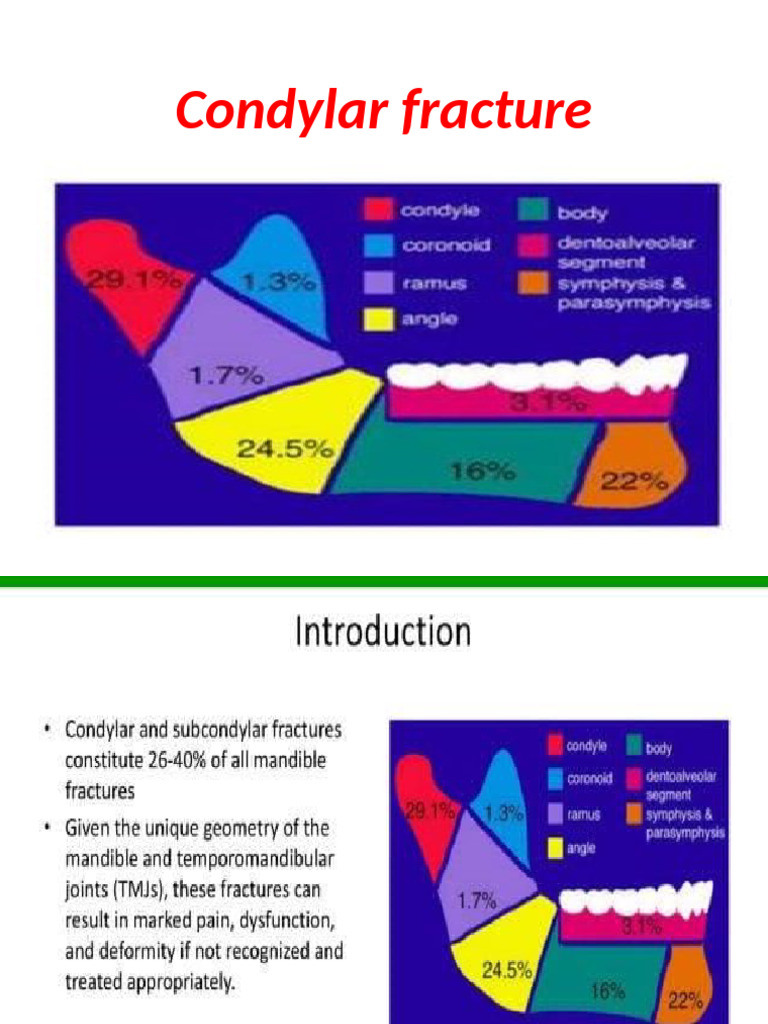 Condylar fracture | PDF