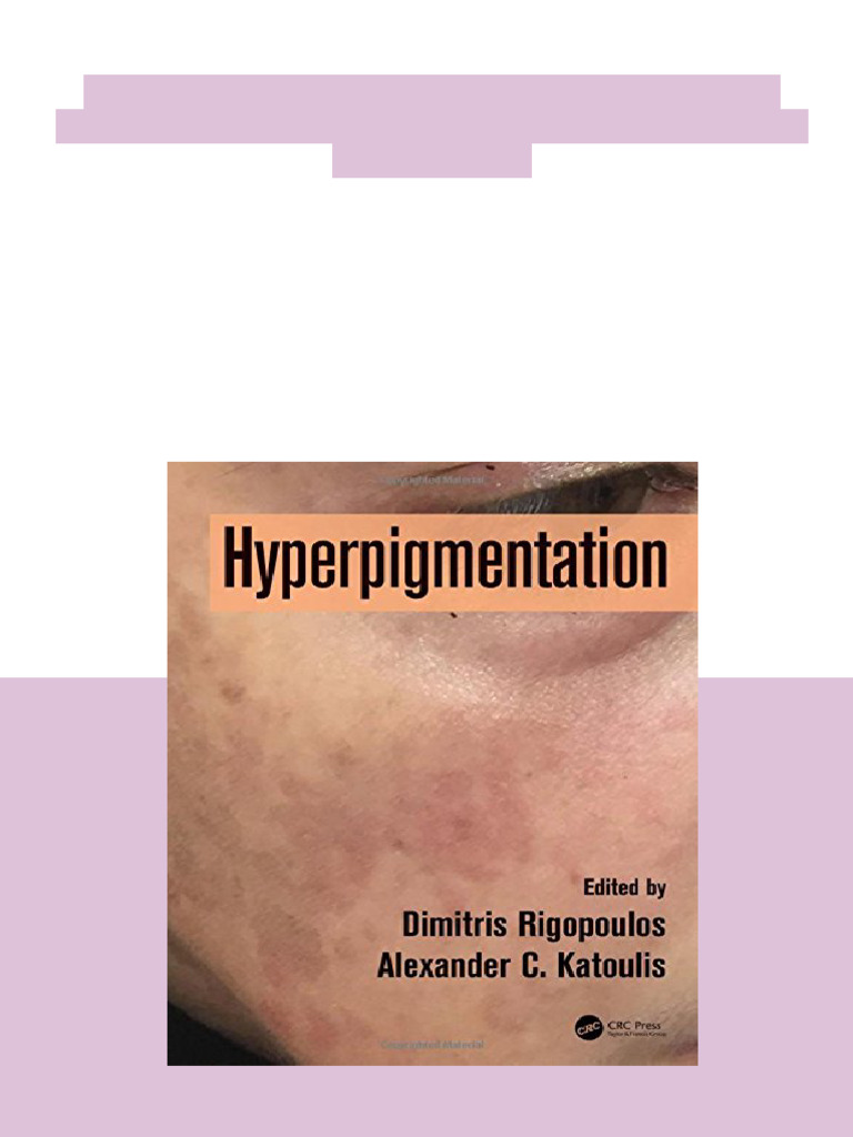 (Ebook) Hyperpigmentation by Dimitris Rigopoulos, Alexander C. Katoulis ...