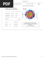 Barrett Toric IOL Calculator v2.0 | PDF