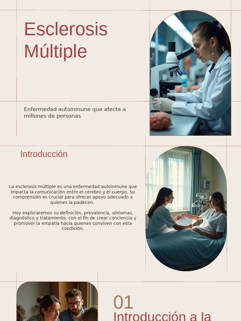 Esclerosis Múltiple | PDF | Esclerosis múltiple | Especialidades Medicas