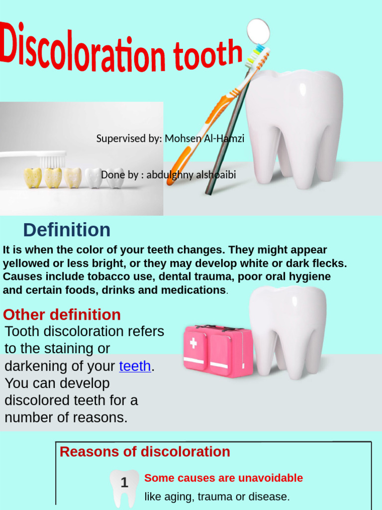 Discoloration Tooth1 | PDF | Human Tooth | Tooth Enamel