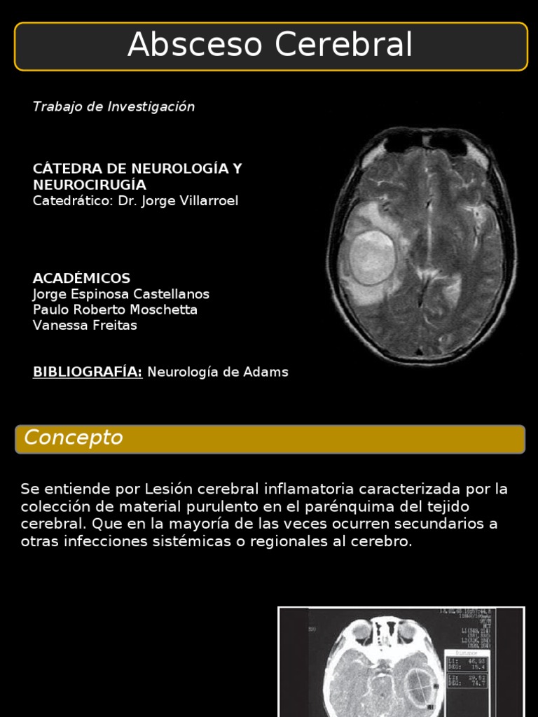 Absceso Cerebral: Causas y Tratamiento | PDF | Cerebro | Antibióticos
