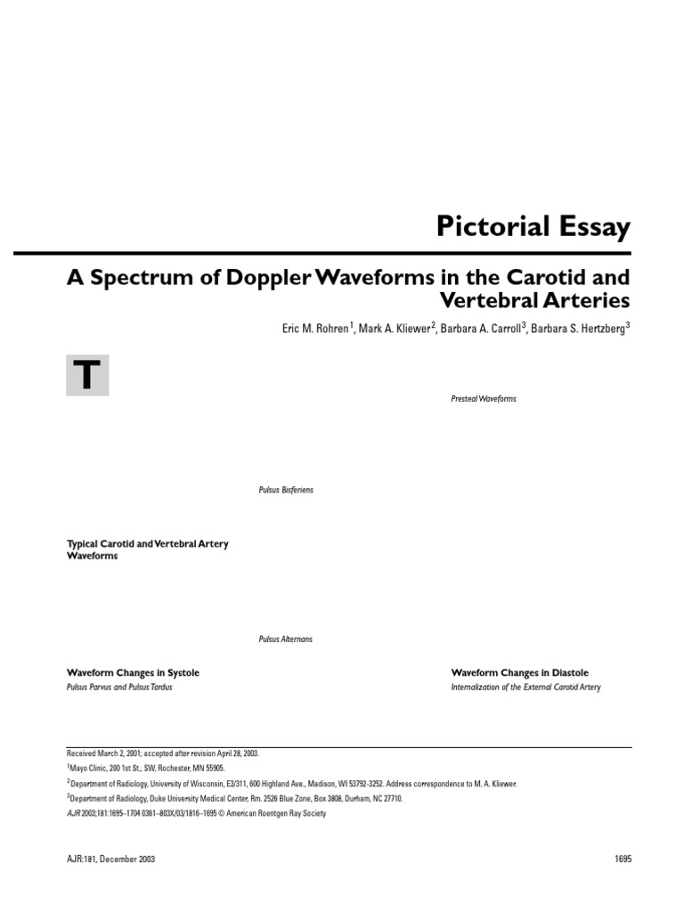 A Spectrum of Doppler Waveforms in The Carotid and Vertebral Arteries ...