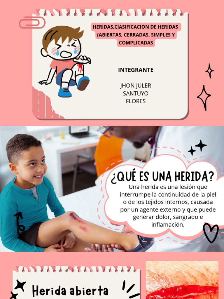 Clasificación de Heridas: Abiertas, Cerradas, Simples y Complicadas ...