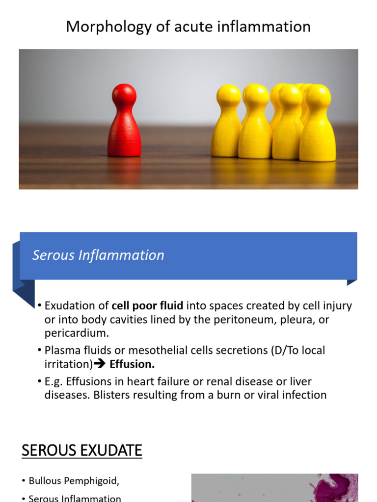 4.Morphologic Patterns of Acute Inflammation | PDF | Inflammation | Necrosis