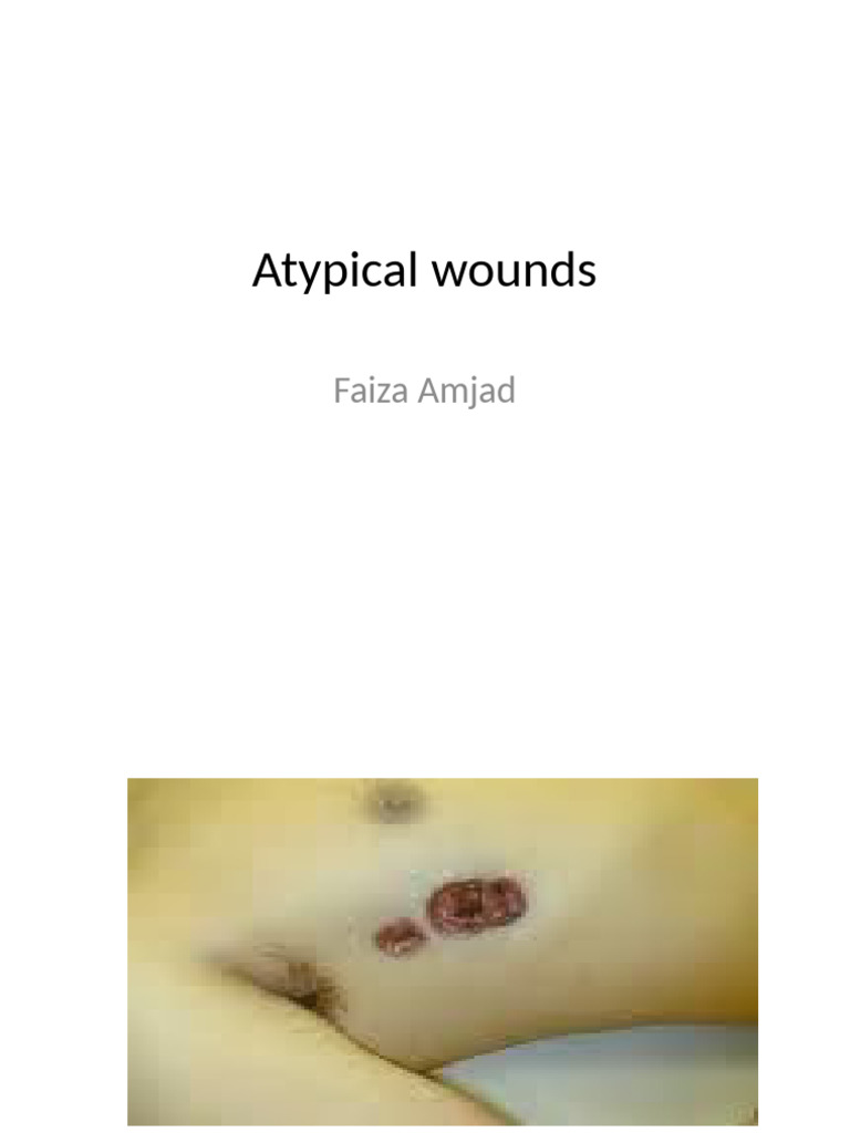 Understanding Atypical Wounds and Treatments | PDF