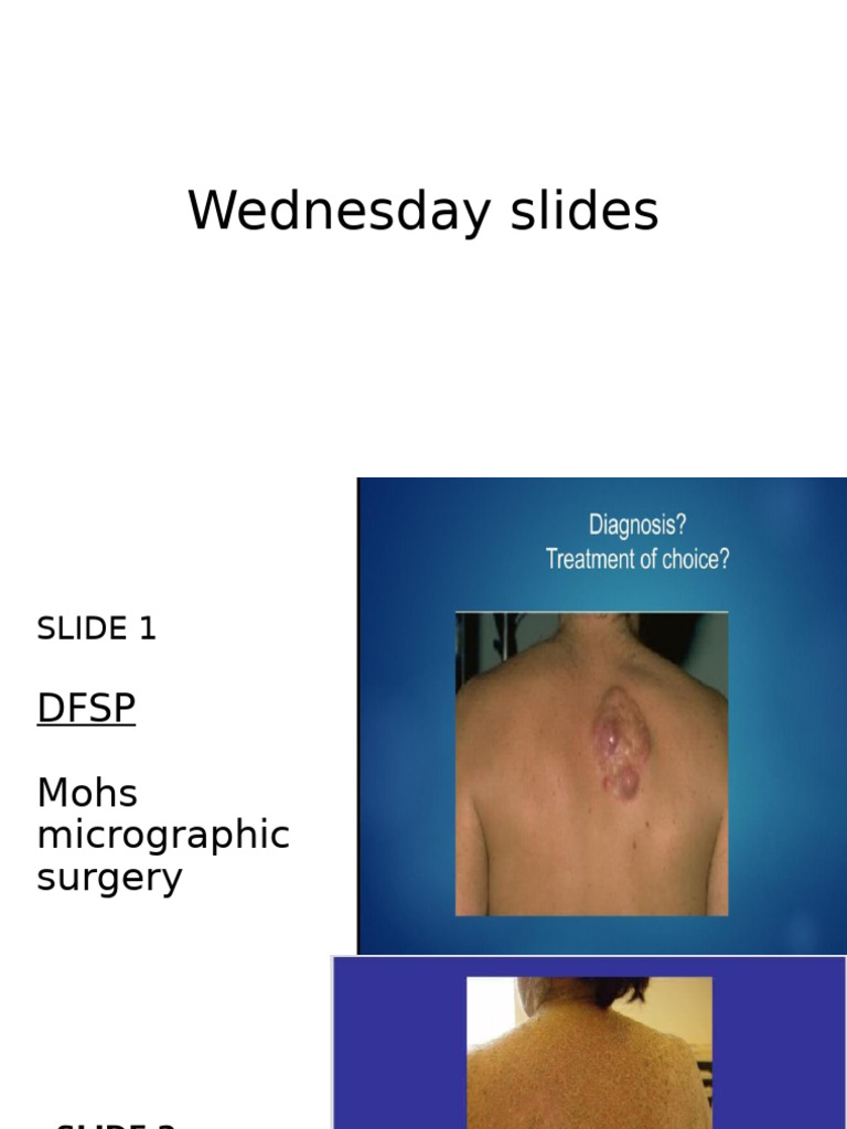 Wednesday Slides | PDF