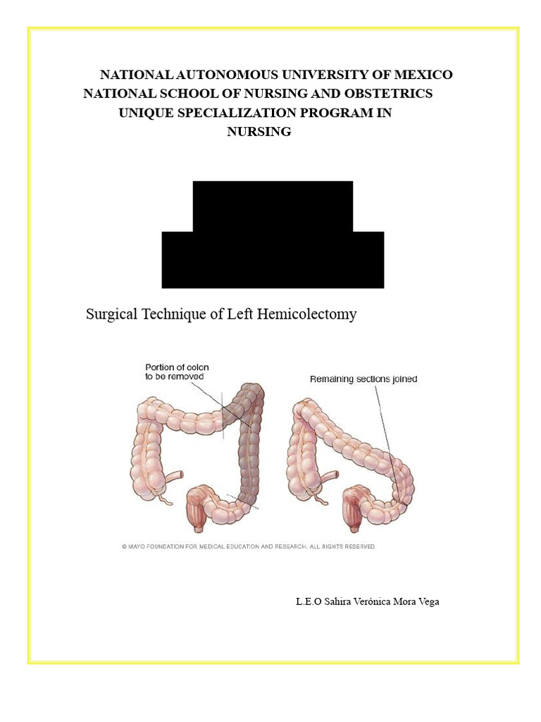 Left Hemicolectomy Surgical Technique Guide | PDF | Surgery | Medical ...