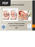 Forceps Delivery: Procedure and Steps | PDF | Childbirth | Clinical ...