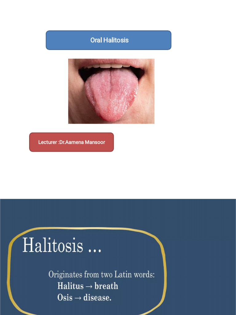 Halitosis | PDF