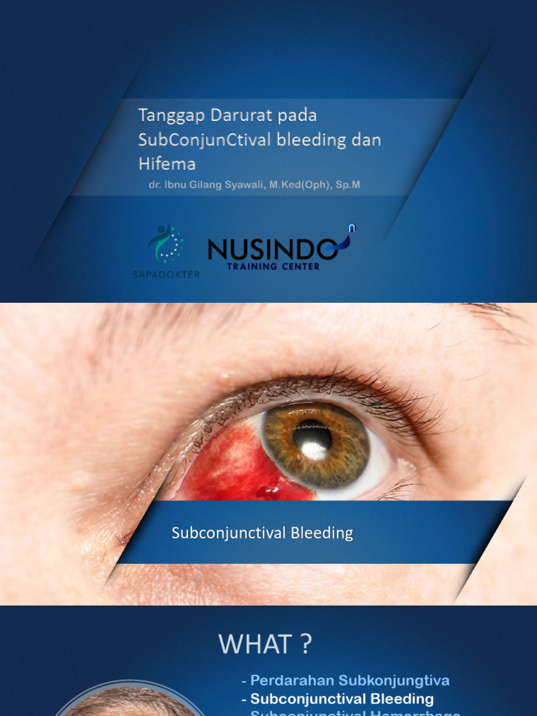 1 Hifema Subconj Hemorrhage | PDF