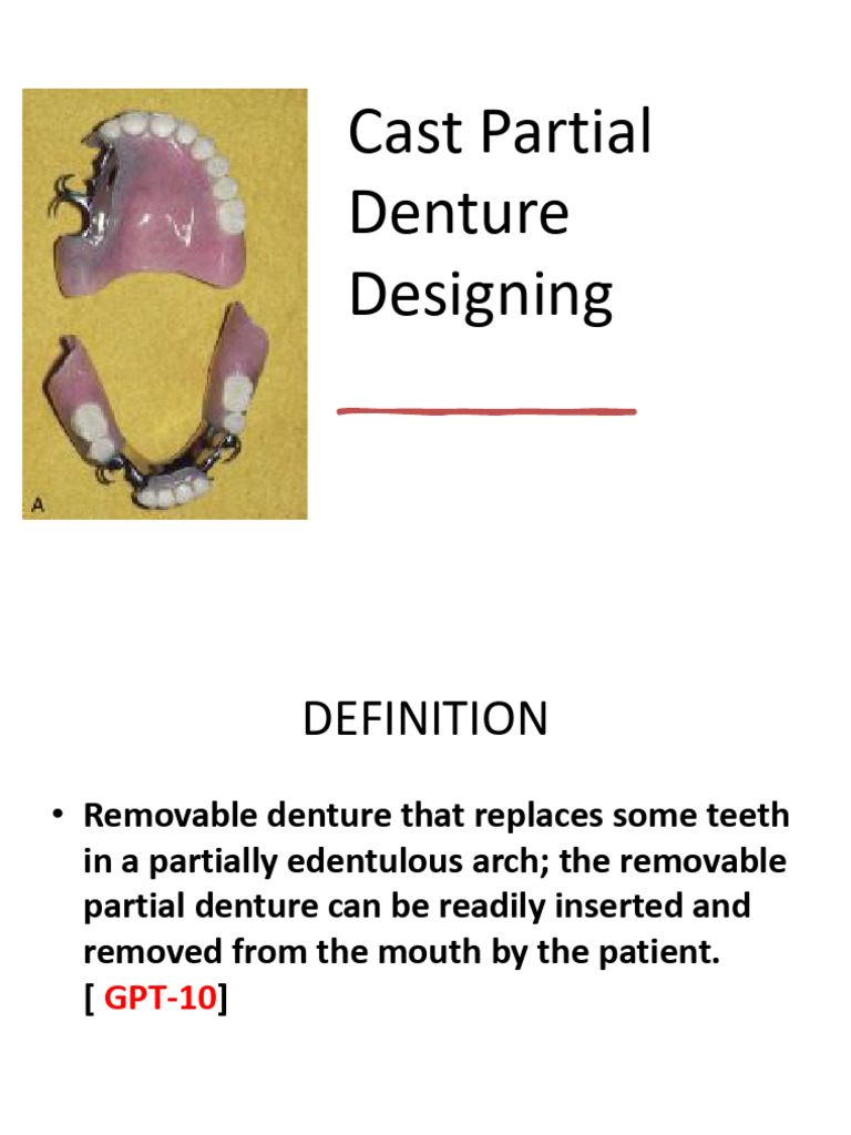 RPD Designing | PDF | Dentistry Branches | Mouth