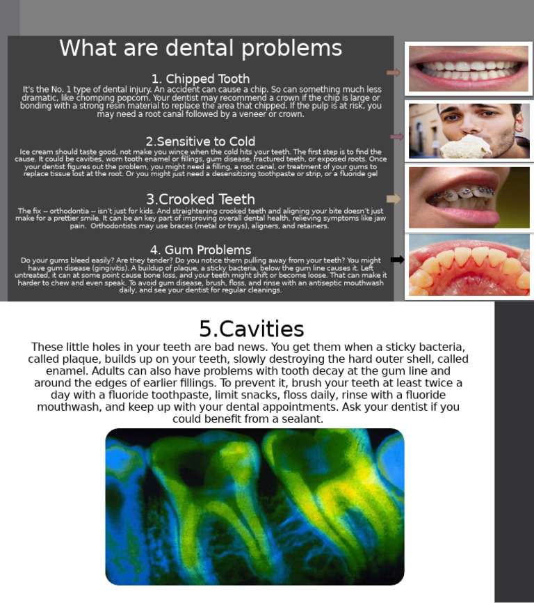 Common Dental Problems Explained | PDF | Health Sciences | Tooth