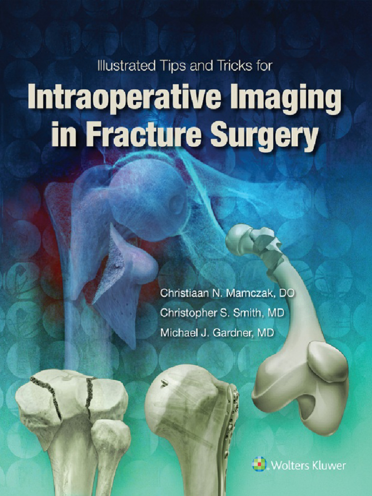 Tips and Tricks ForIntraoperative Imaging in FractureSurgery | PDF ...