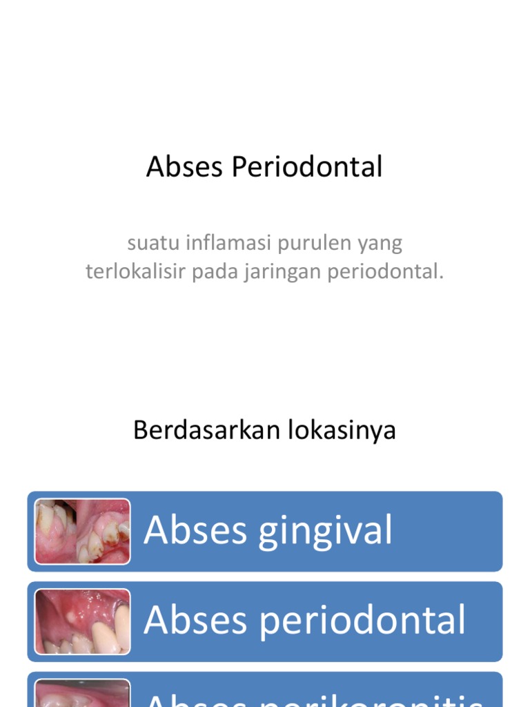 Abses Periodontal | PDF